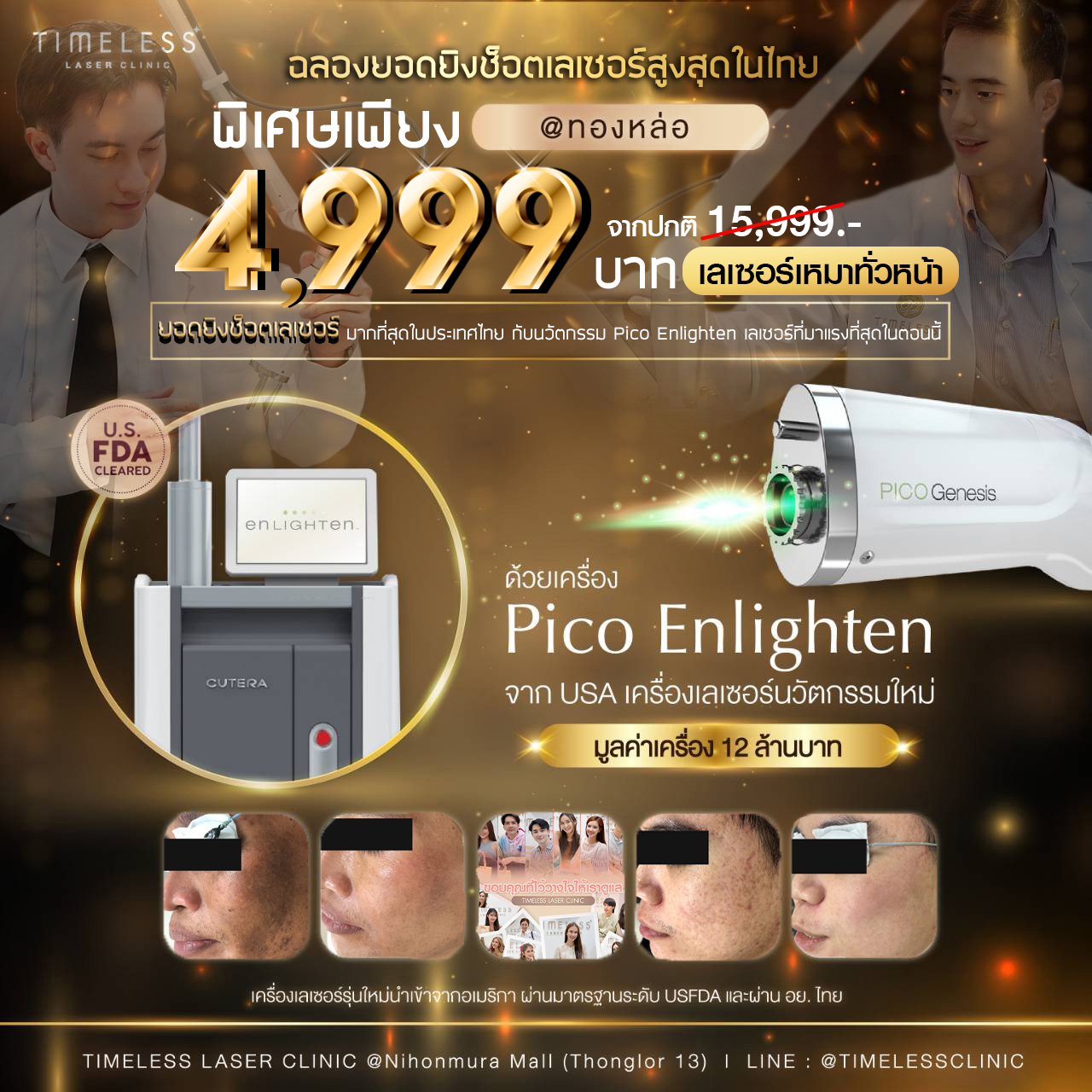 Pico Laser เครื่องแท้ มูลค่า 12 ล้านบาท 7 โปรแกรม – Timeless Clinic